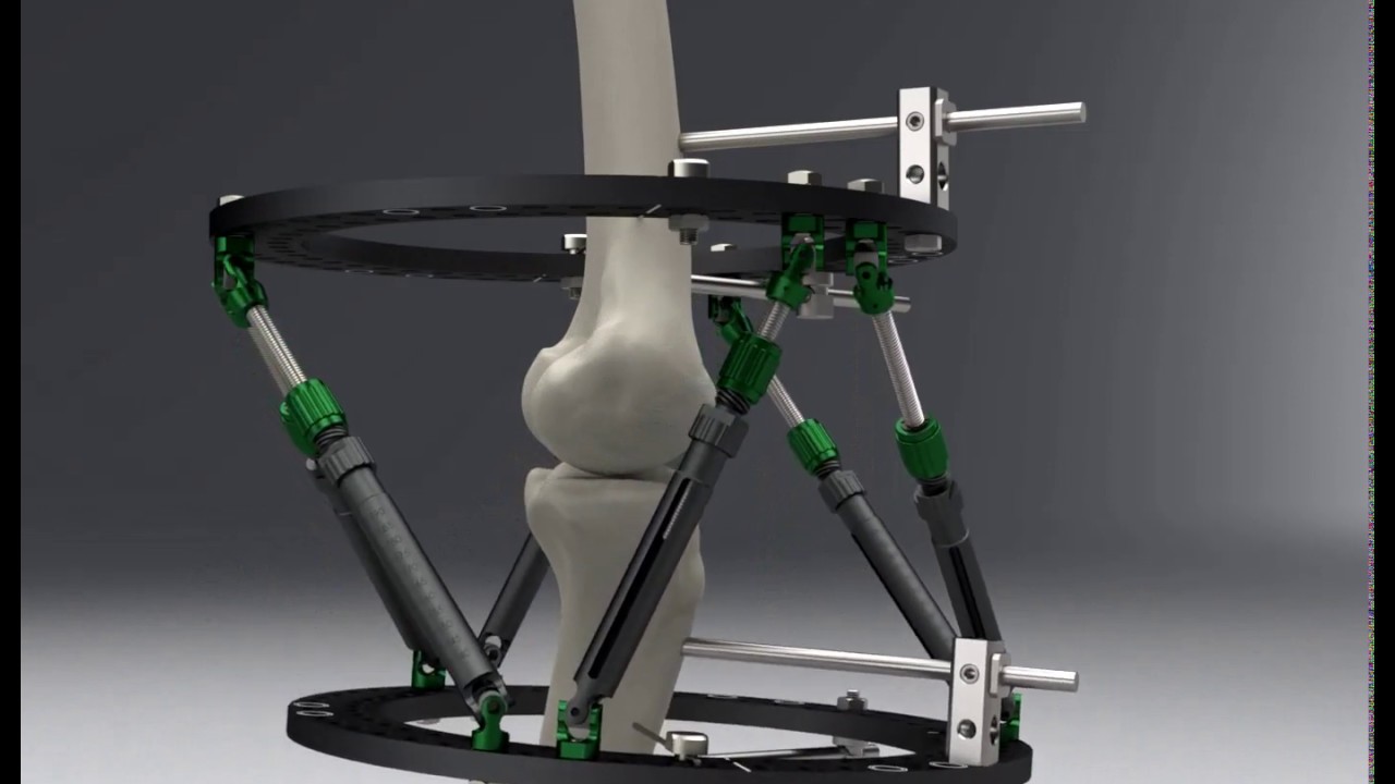 Spider Frame in Action - YouTube