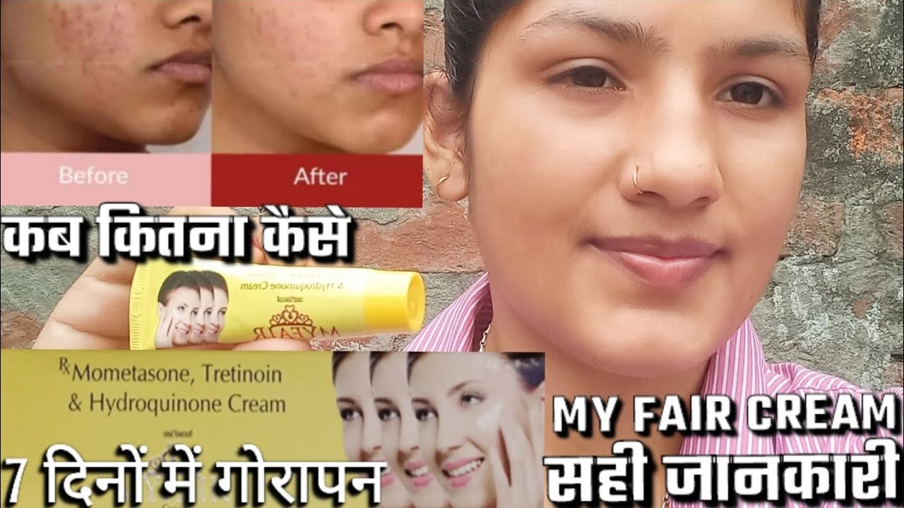 My fair Cream review//uss, side-effects, benifits//3 दिनों में गोरापन ...