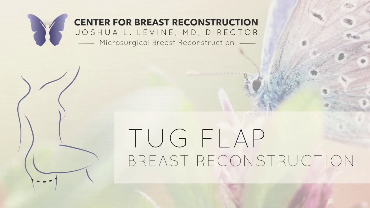 TUG vs PAP Flap Breast Reconstruction - Guided Illustration - By Dr ...