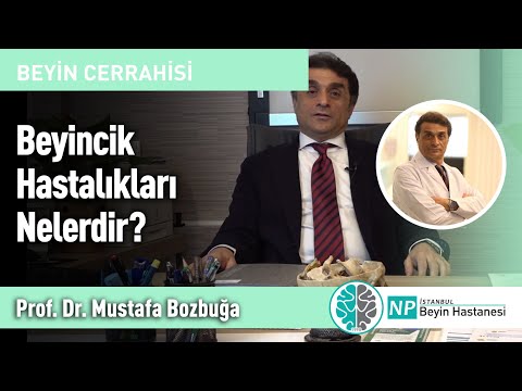 Beyincik Hastalıkları Nelerdir?