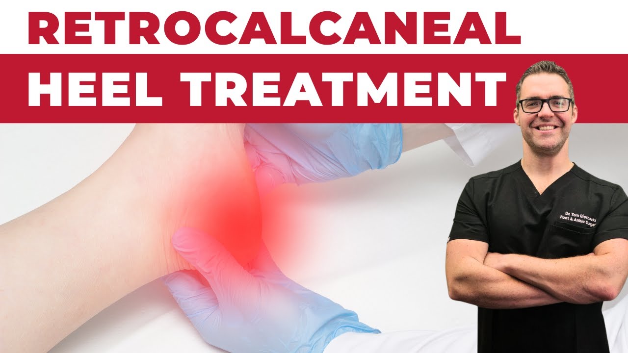 Back Of Heel Pain Fixed Fast [Retrocalcaneal Bursitis Relief] - YouTube
