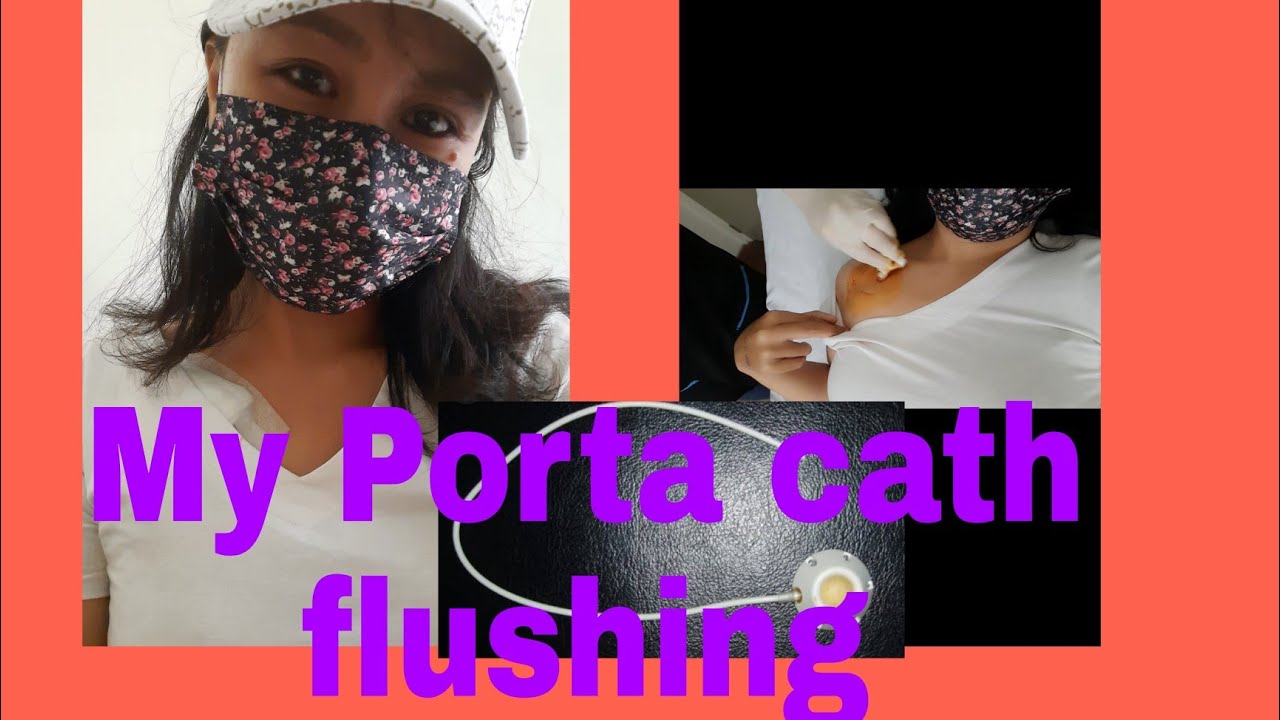 My Porta cath flushing (cancer journey) #breastcancersurvivor # ...