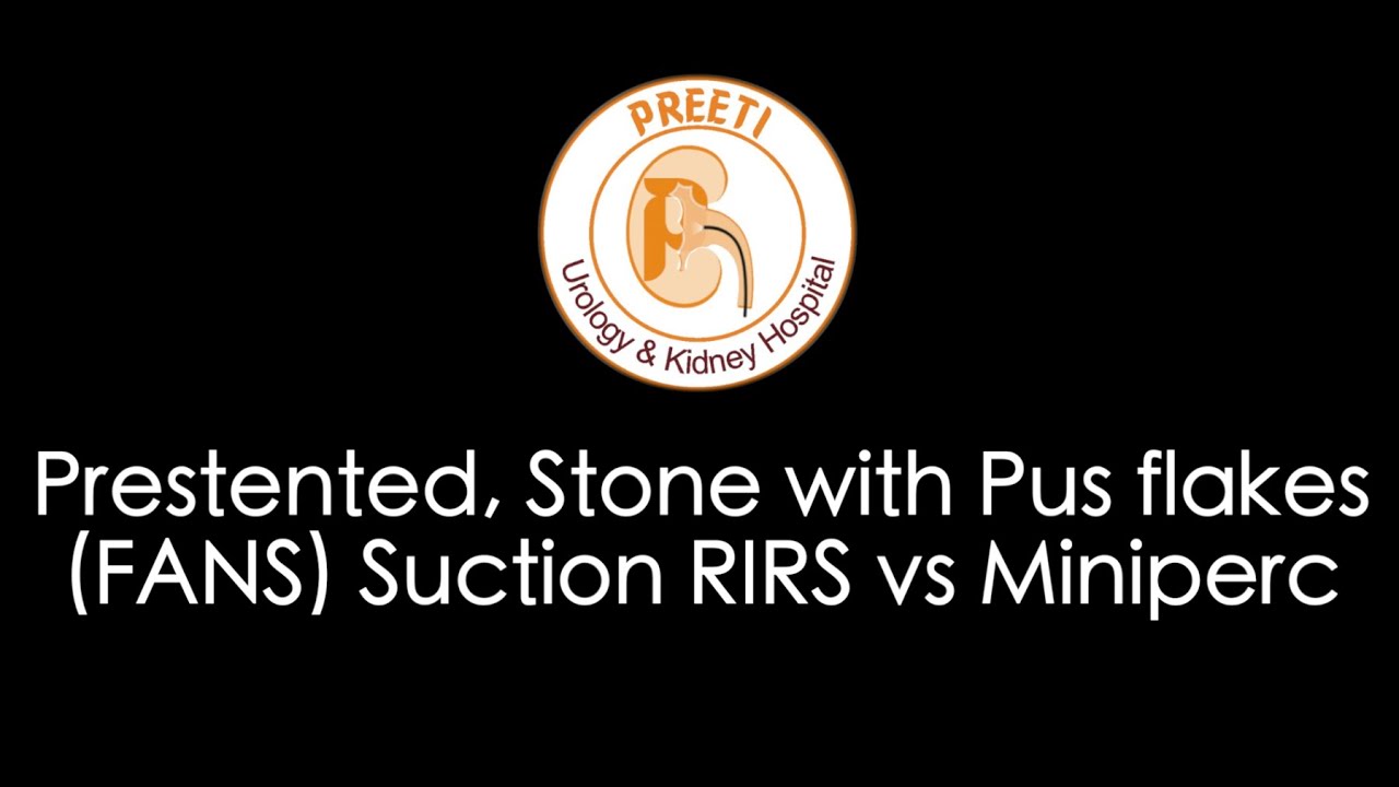 Prestented, Stone with Pus flakes (FANS) Suction RIRS vs Miniperc - YouTube