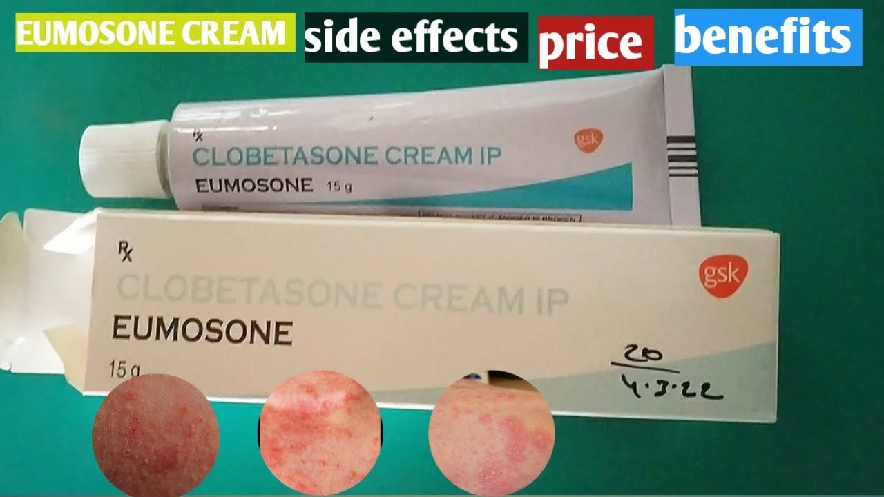 Eumosone Cream full review in hind Clobetasone cream Eumosone Cream ...