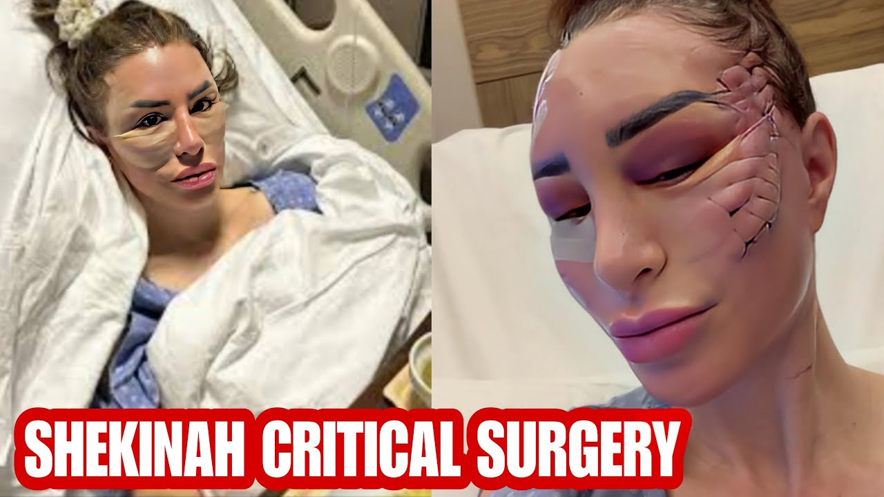 "Shekinah's Shocking Surgery Reveal:😱 Sarper's Heartbroken Reaction on ...