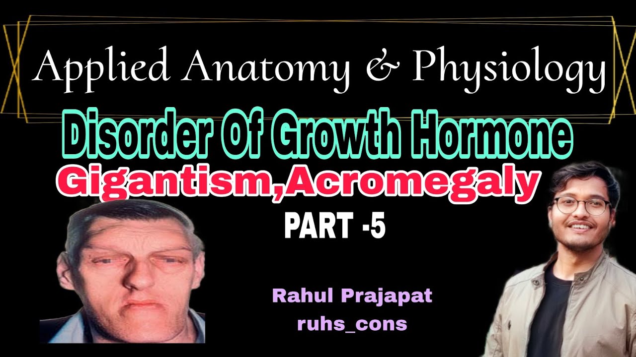 DISORDER OF GROWTH HORMONE || GIGANTISM || ACROMEGALY #gigantic # ...