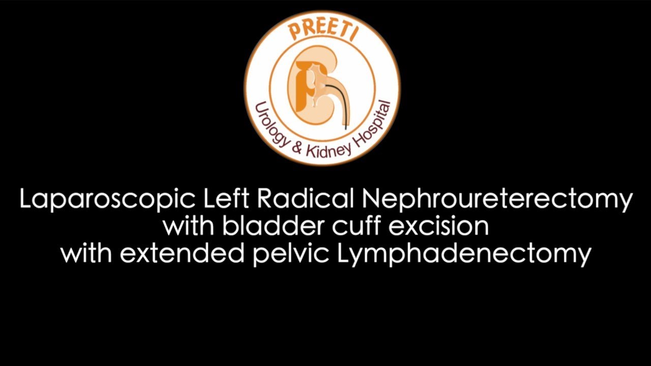 Large lower Ureteric Tumor Bladder cuff excision video - YouTube