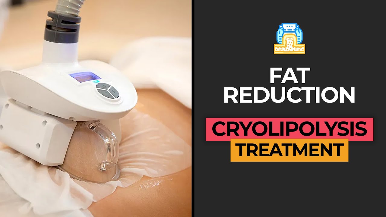 Cryolipolysis: Benefits & Treatment | HASH CLINICS - YouTube