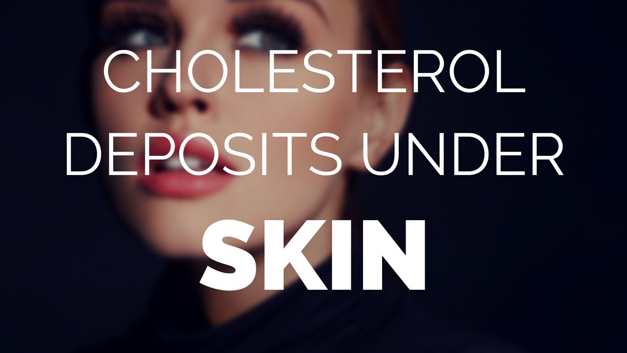 Cholesterol deposits under skin and how to treat them. - YouTube