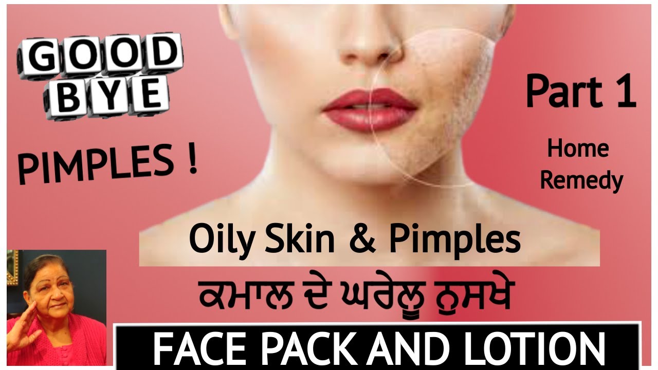 Oily skin pimples acne home remedy | Gharelu nuskhe | get rid of ...