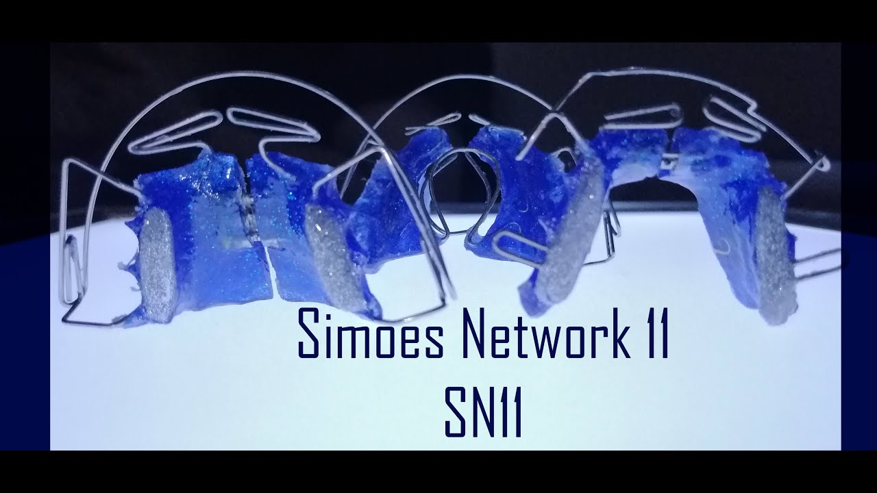 Elaboración de SN11 Simoes Network 11 | Elena Dental Art & More - YouTube