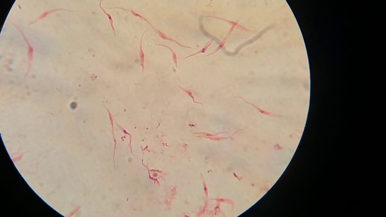 Trypanosoma cruzi epimastigote - YouTube