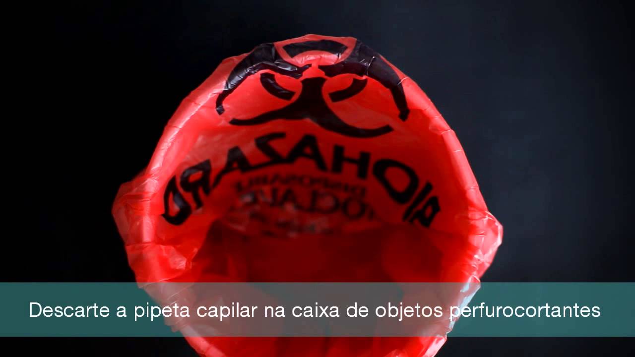 SD BIOLINE HIV Syphilis Duo Training Video Whole Blood Portuguese - YouTube
