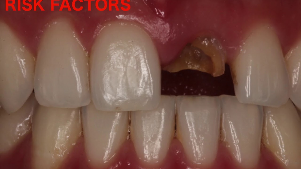 SOFT TISSUE SURGERY - LIVE training - YouTube