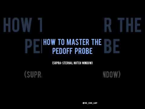 How to master the Pedof probe! (SSN window)! 🫀