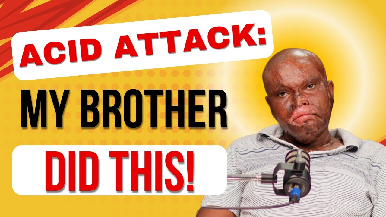 Betrayed by Blood: How My Brother Poured Acid On Me ( The EX STORY with ...