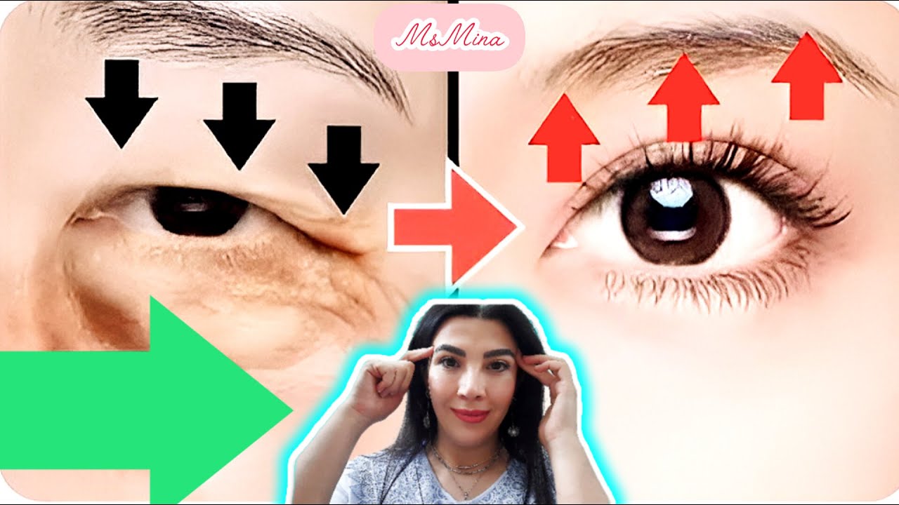 5mins 💥 Bigger Eye Exercises For Puffy Eyes , Eye Bags, Dark Circles ...