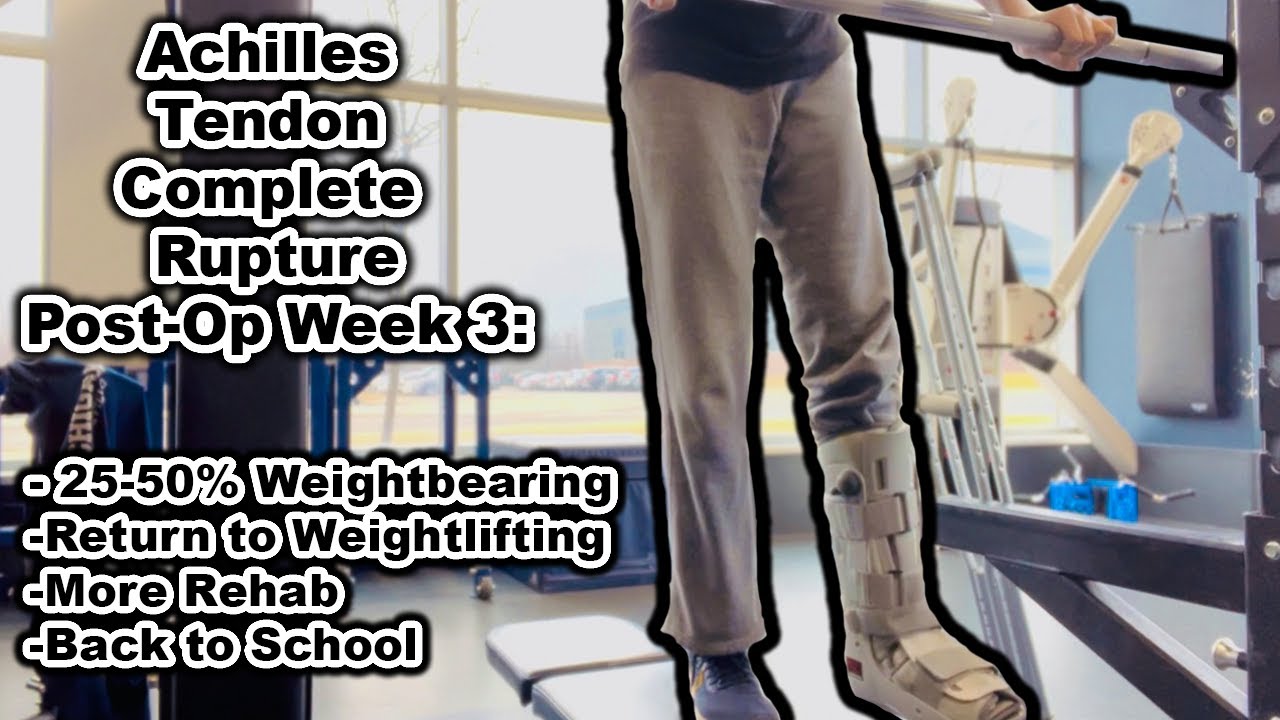 [Week 3] Achilles Tendon Rupture (College Athlete) - Surgical Recovery ...