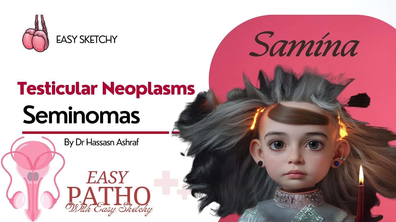 Testicular Neoplasms Pathology | Seminomas | Visual mnemonics | Male ...