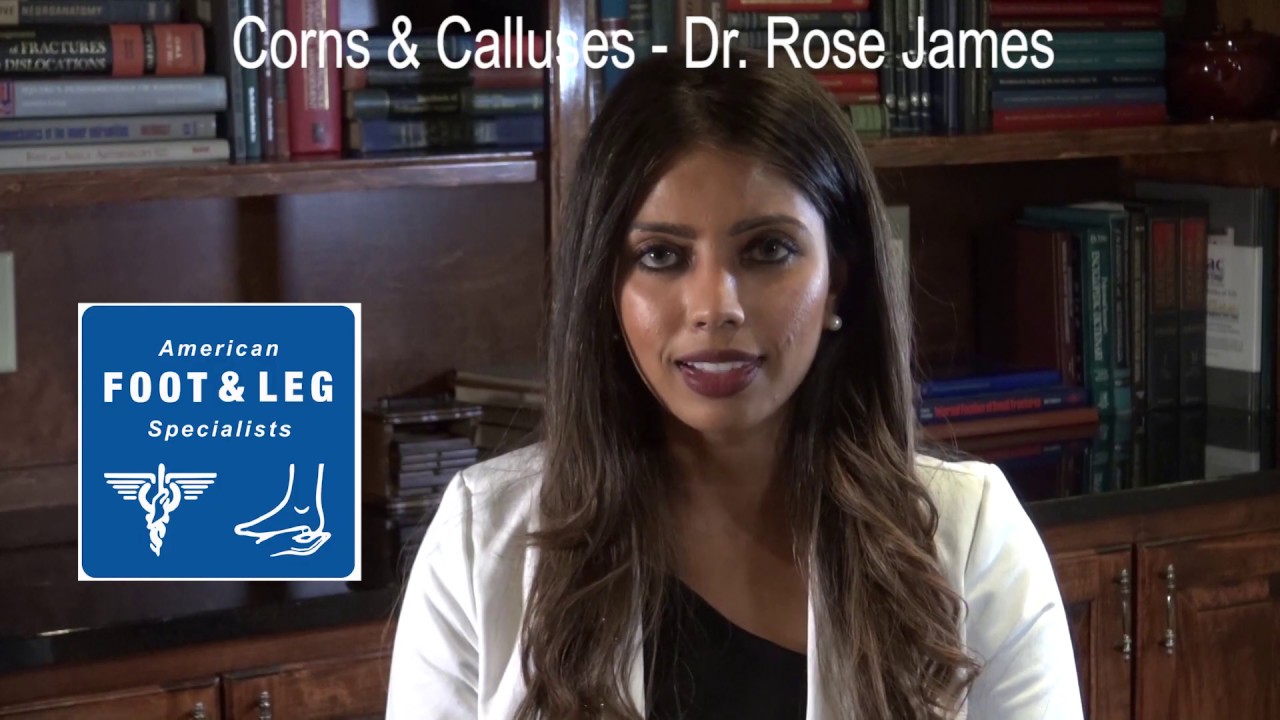 Dr James Corns Calluses - YouTube