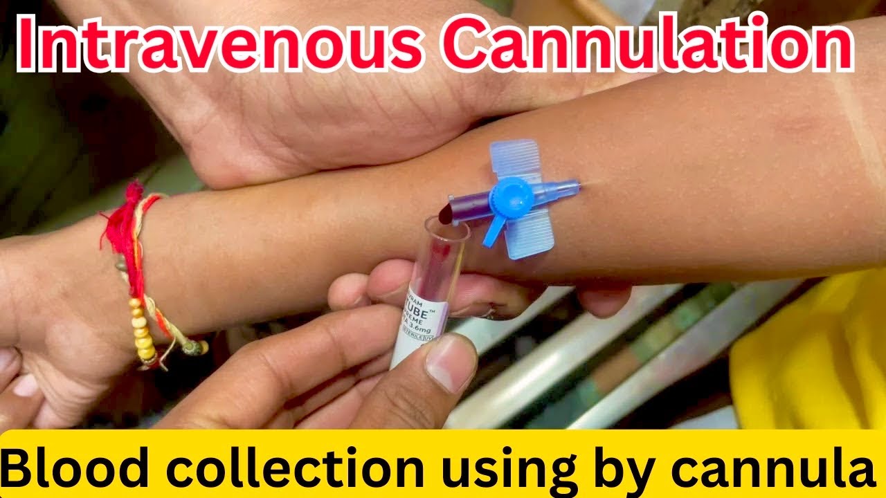 Intravenous Cannulation || कैनूले से blood कैसे निकाले || blood ...