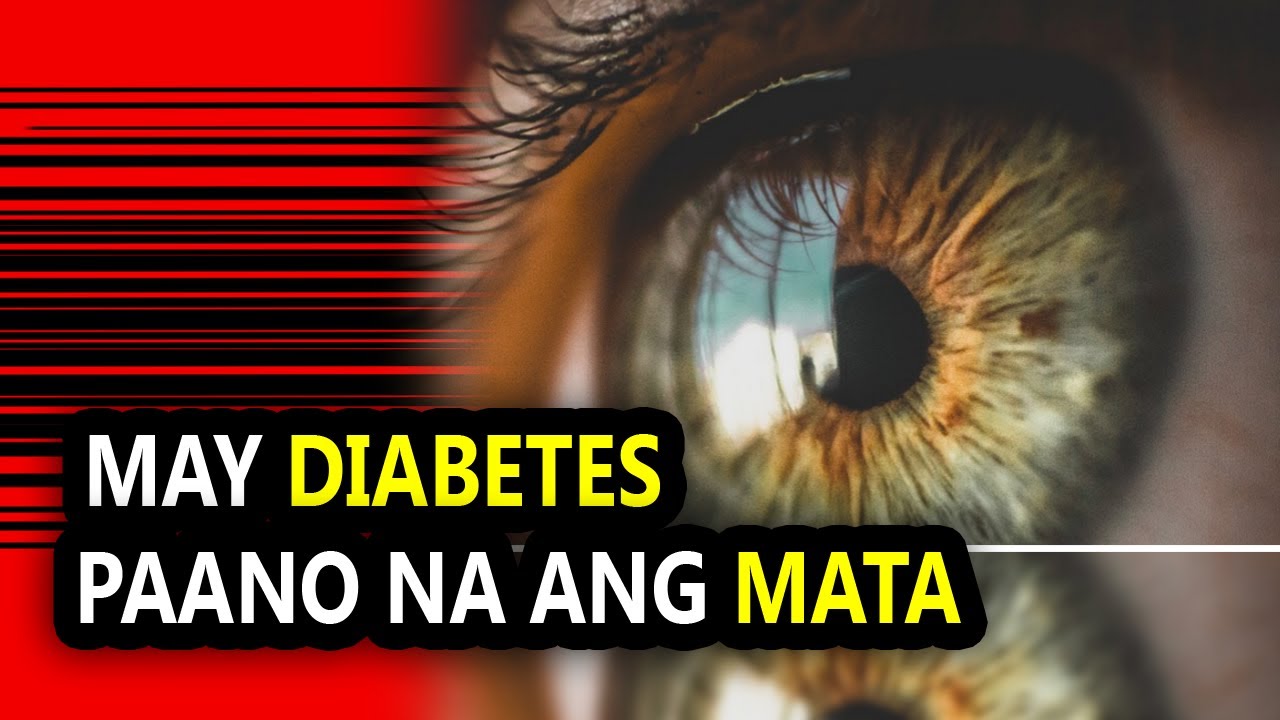 May DIABETES, paano na ang MATA - YouTube