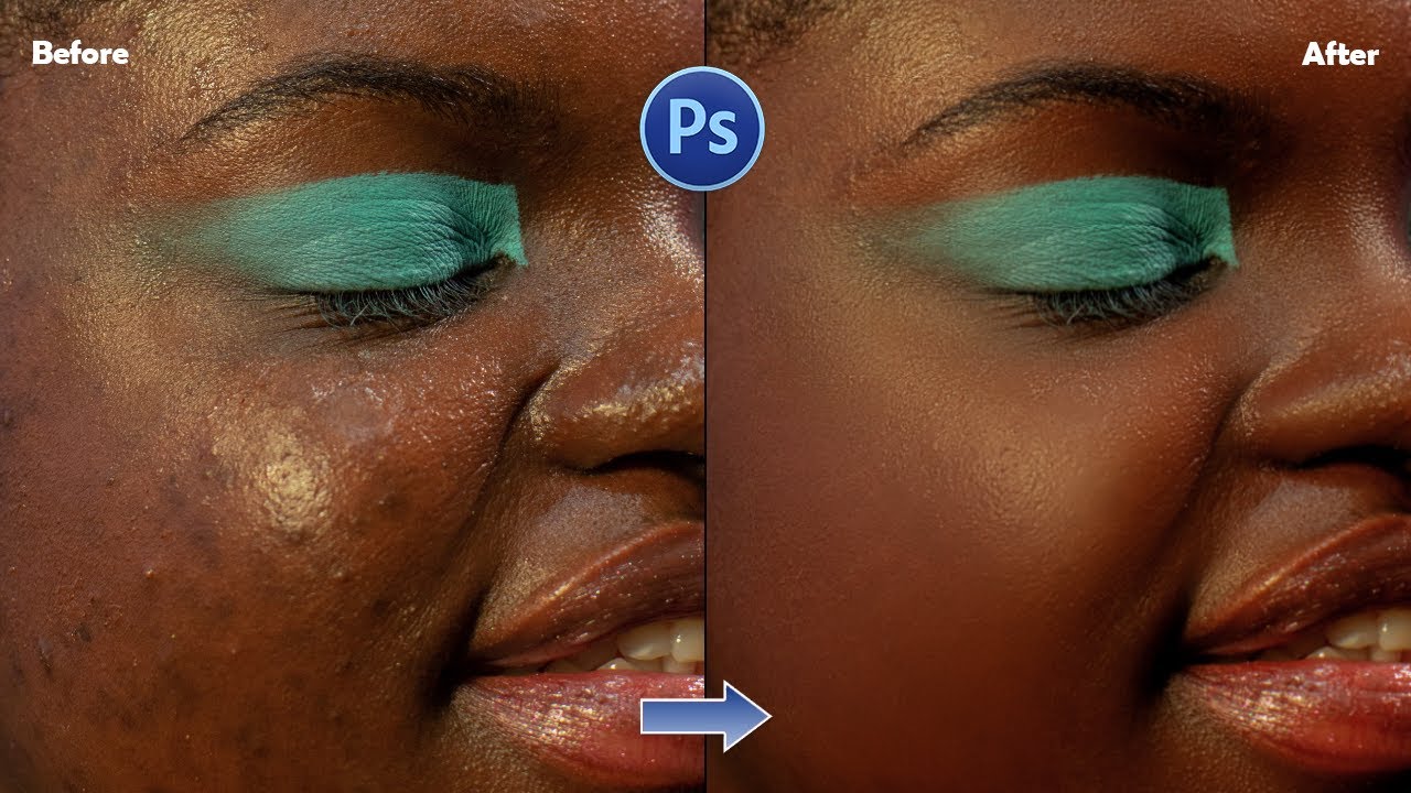 High-End Skin Retouching In 5 Minutes In Photoshop - YouTube