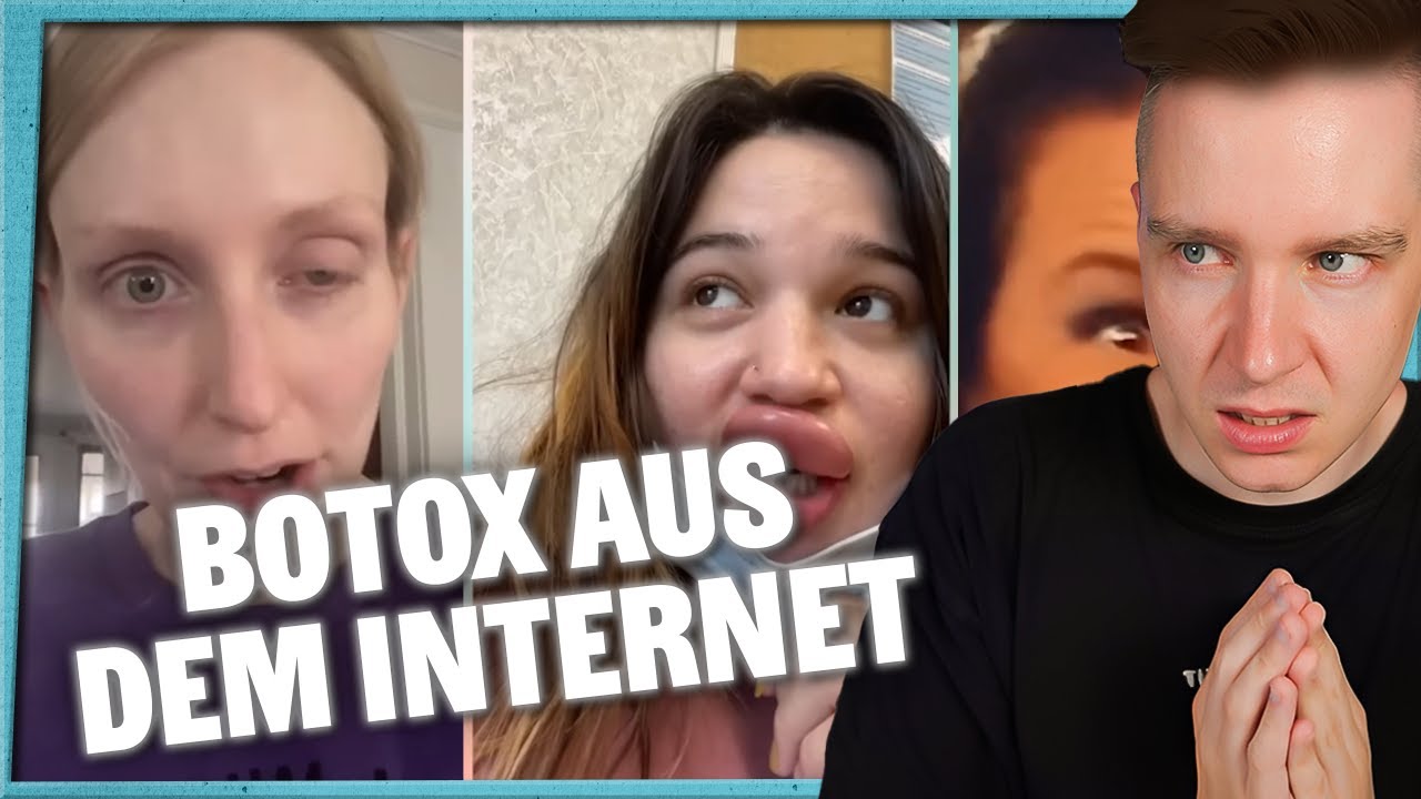 Die SCHLIMMSTEN Botox-FAILS - NICHT NACHMACHEN - YouTube