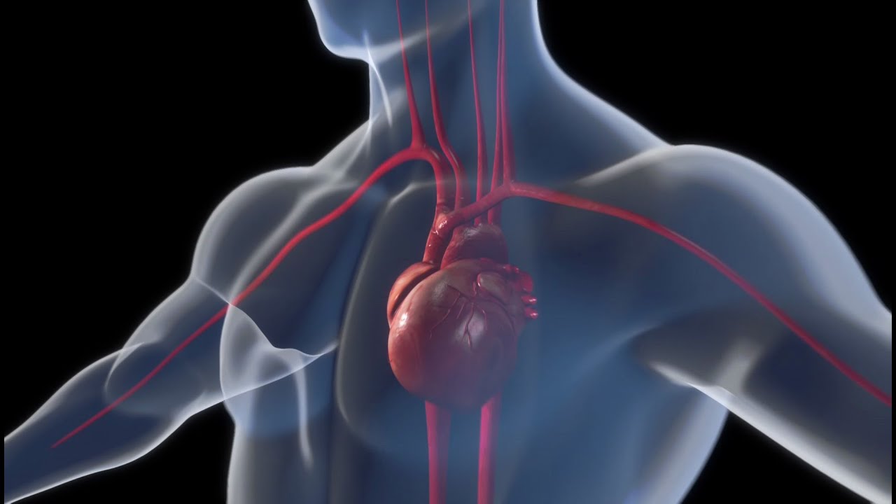 An innovative cardiac support system for weakened hearts - YouTube