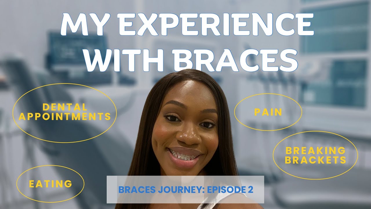 My Braces Journey: My Braces Experience - YouTube