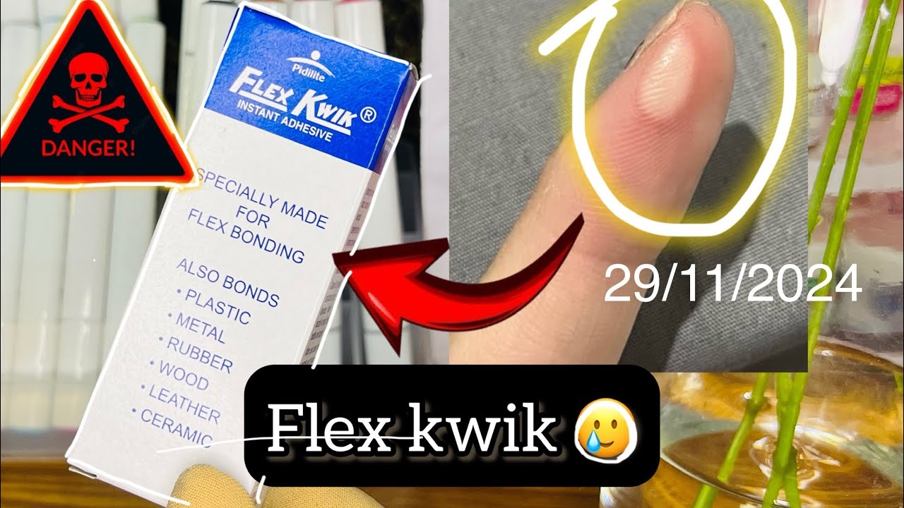 How to Treat a Thumb Burn from Flex Kwik Adhesive || craft gum #craft - YouTube