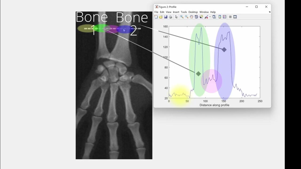 Matlab Thresholding, image segmentation, edge detection, image processing - YouTube