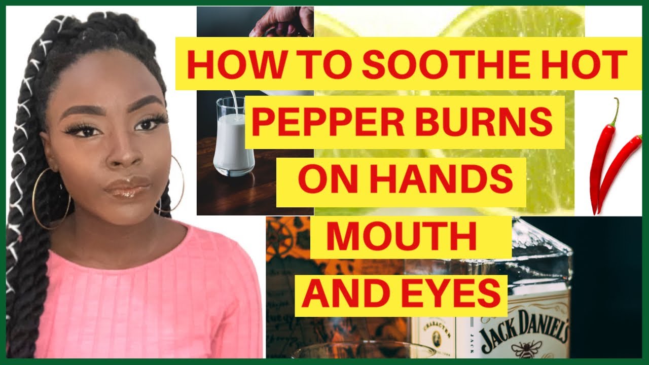 FIRST AID SOLUTIONS TO HOT PEPPER BURNS - YouTube