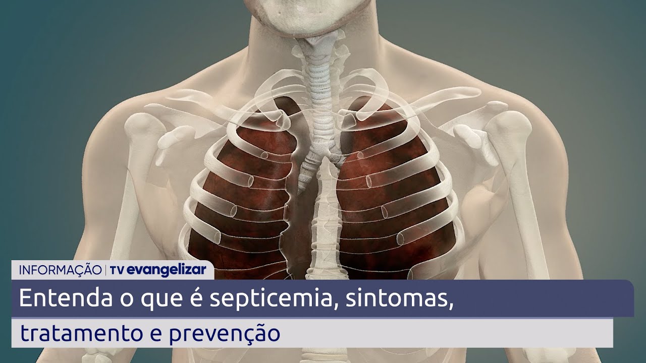 Entenda o que é septicemia, sintomas, tratamento e prevenção - YouTube