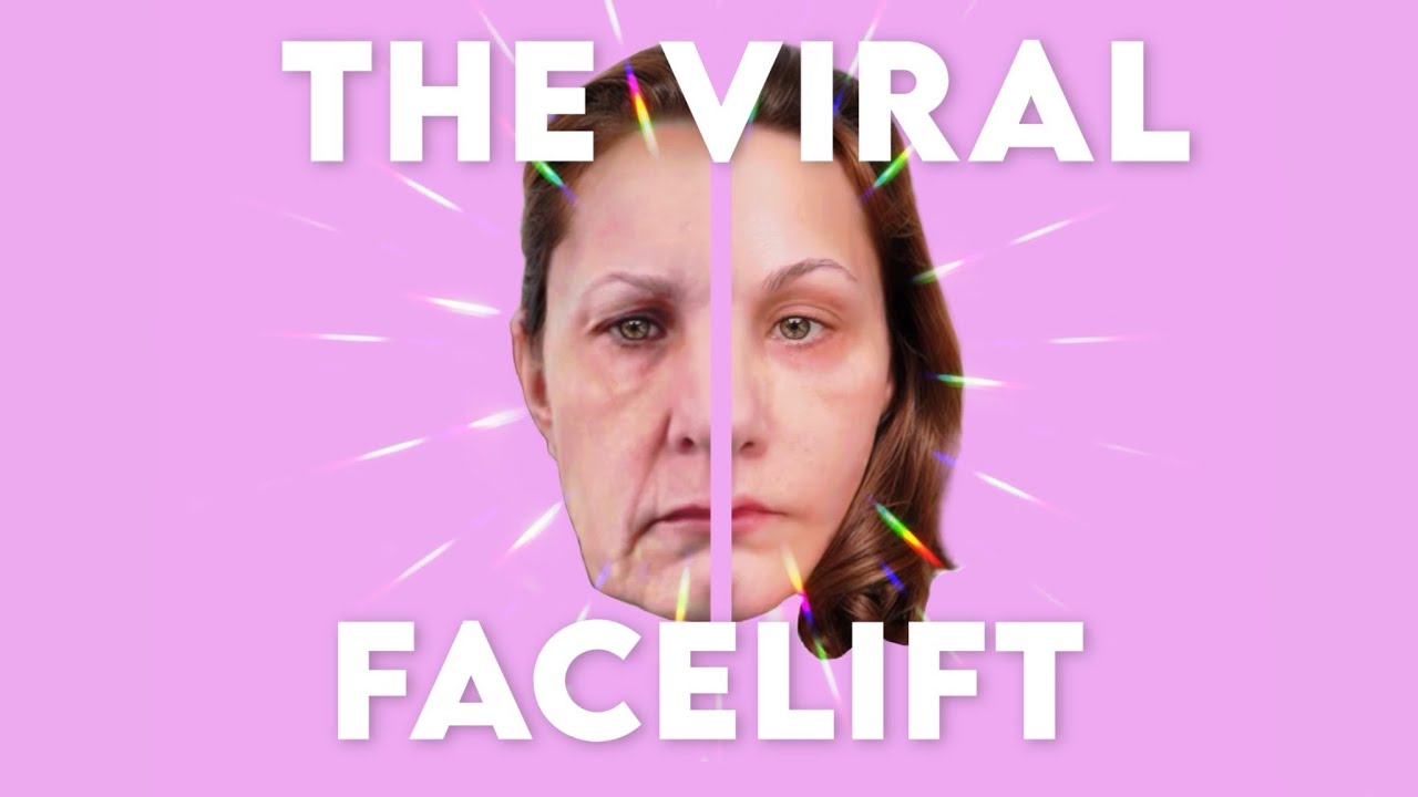 Michelle Wood’s Viral Facelift and Why I Chose Dra Maribel Belmontes in ...