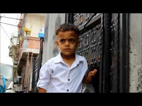 RESUL BABA AYRILIK ACISI