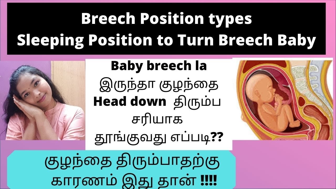 Breech Position Types Sleeping Position To Turn Breech Baby In Tamil breech-position-types-sleeping-position-to-turn-breech-baby-in-tamil