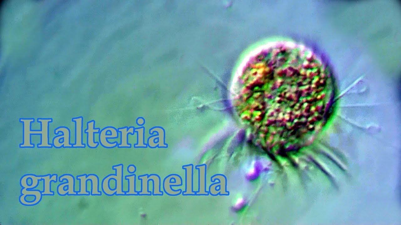 Halteria grandinella - YouTube