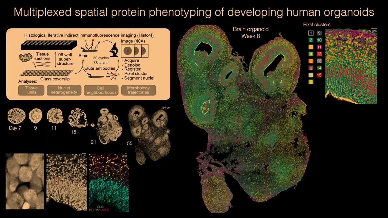 Combining Artificial Intelligence with single cell and organoid technologies Treutlein & Theis 5 ...