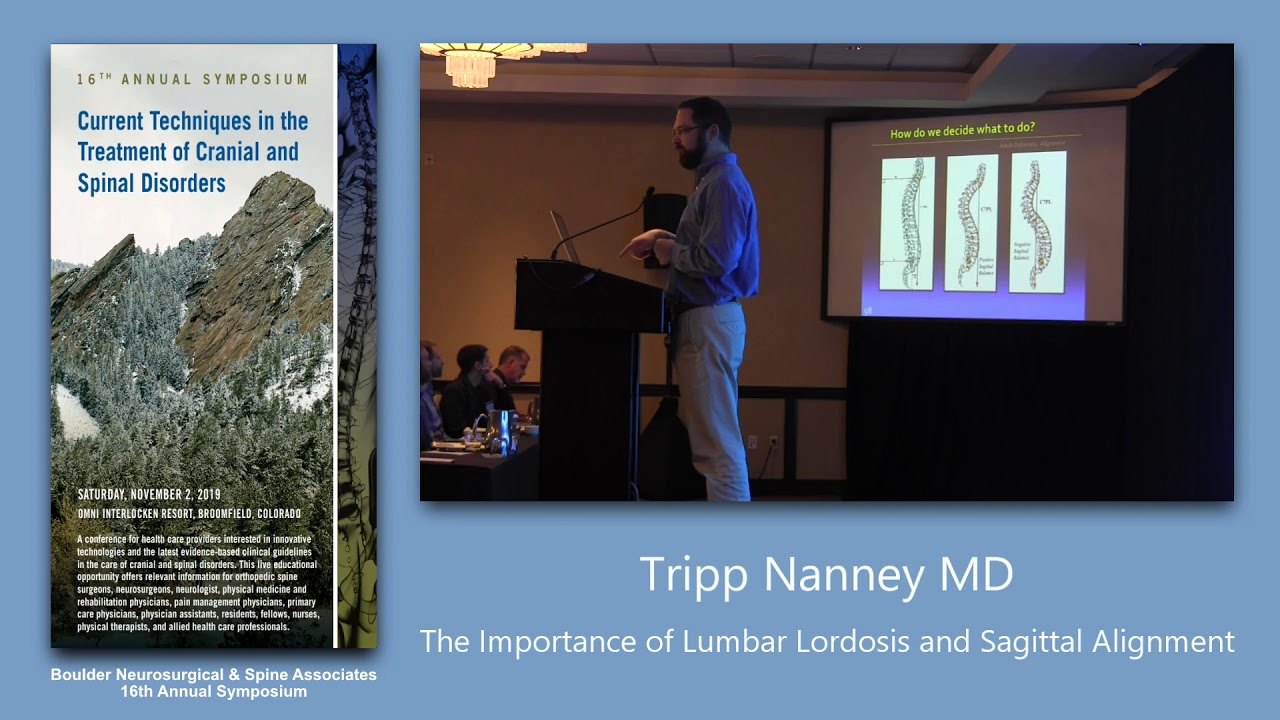 Allan D. "Tripp" Nanney, III, MD | The Importance of Lumbar Lordosis ...