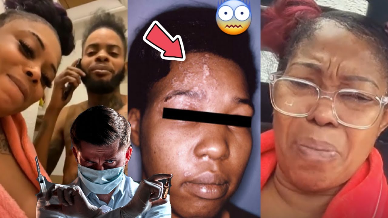 Queen Ladi Gangster Expose her Husband Dowey Gave her Herpes (vįŕůś ...