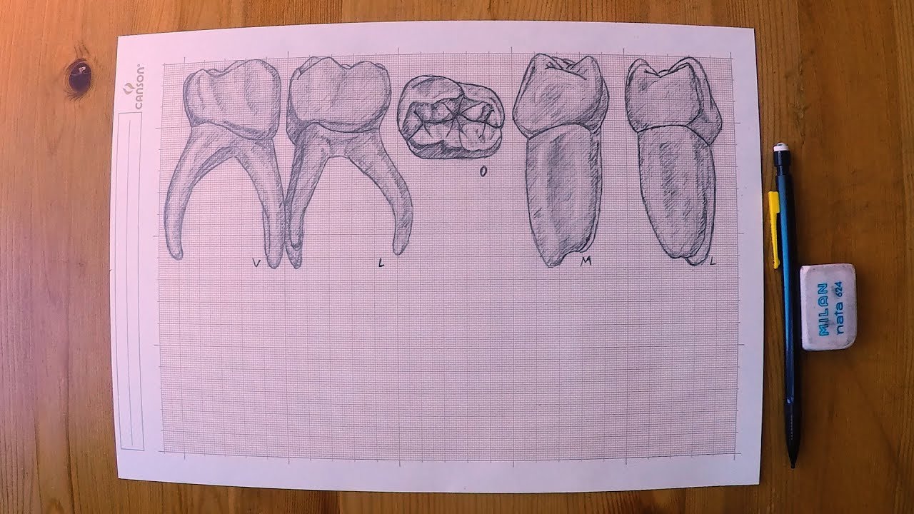 FDI 8.4.; Haderup: d-. Anatomical dental drawing. Dibujo anatómico ...