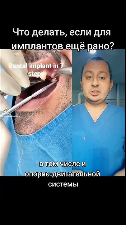 #стоматолог #стоматология #имплант #имплантат #имплантациязубов # ...