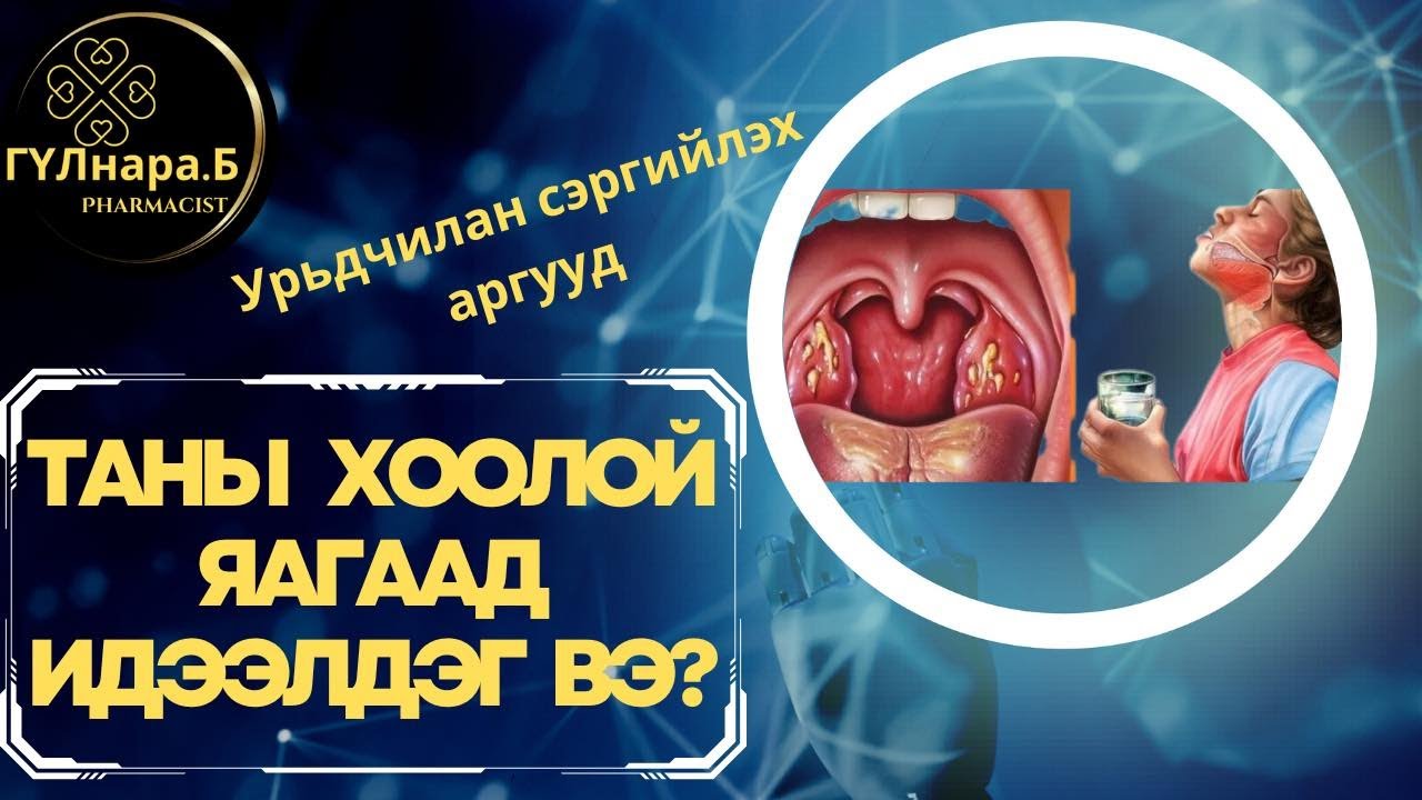 Гүйлсэн булчирхайн үрэвсэл Хоолойн идээт үрэвсэл дахиж тусахгүй байх