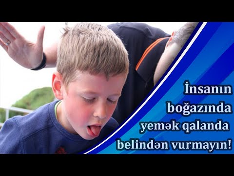 Boğazda yemək qalarkən qətiyyən belindən vurmayın! Yaxşısı bunu edin