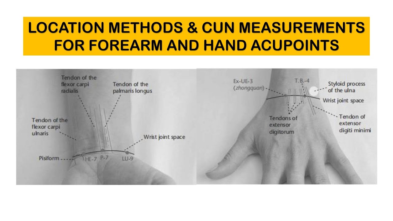 LOCATION METHODS AND CUN MEASUREMENTS FOR FOREARM AND HAND ACUPOINTS ...