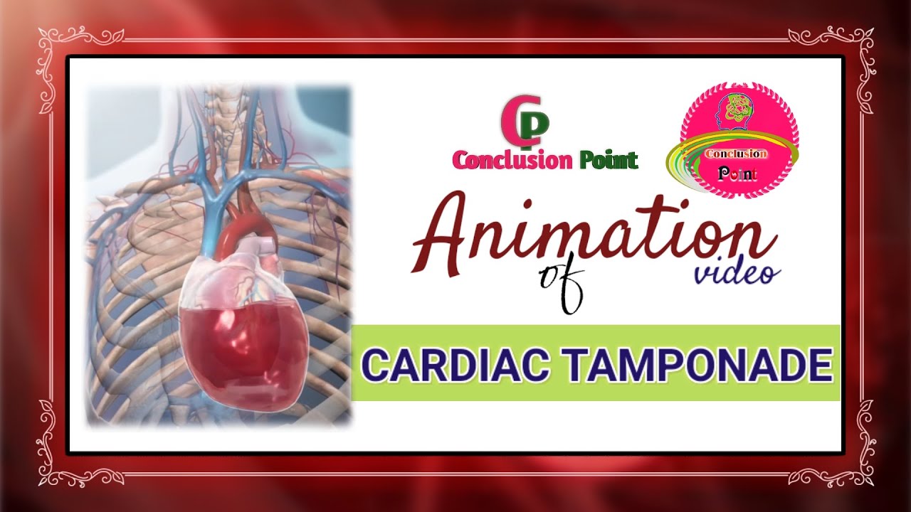 CARDIAC TAMPONADE || Cardiovascular Problem || Animation Video ...