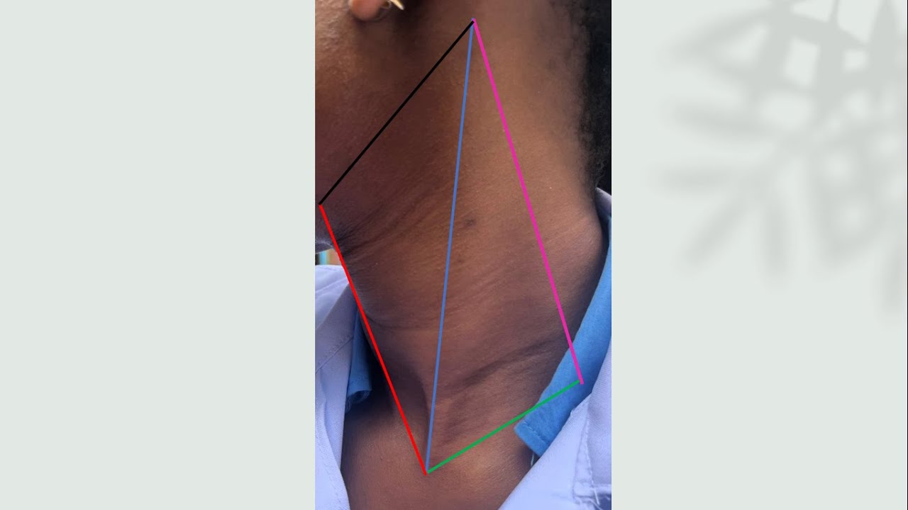 ANATOMY OF THE POSTERIOR NECK TRIANGLE - YouTube