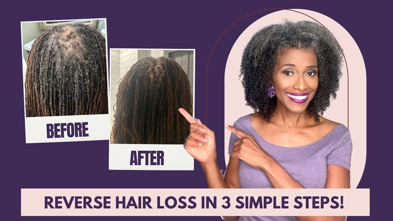 How to Reverse Hair Loss: 3 Proven Strategies - YouTube