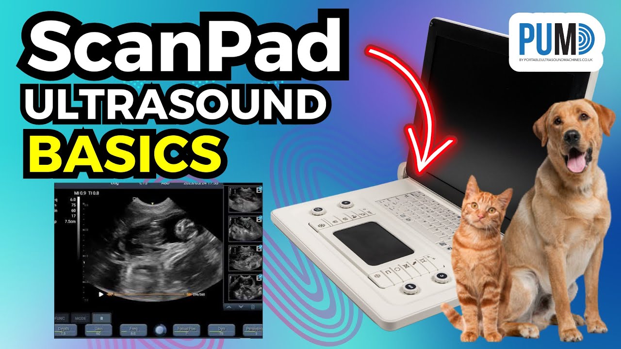 ScanPad ultrasound basics - YouTube
